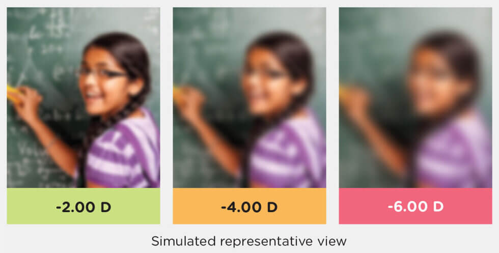 Introducing ACUVUE® Abiliti™ Contact Lenses - Kodak Lens Vision Centre